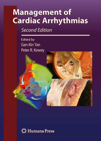 Management of Cardiac Arrhythmias, Springer, eBook, PDF - BUKU