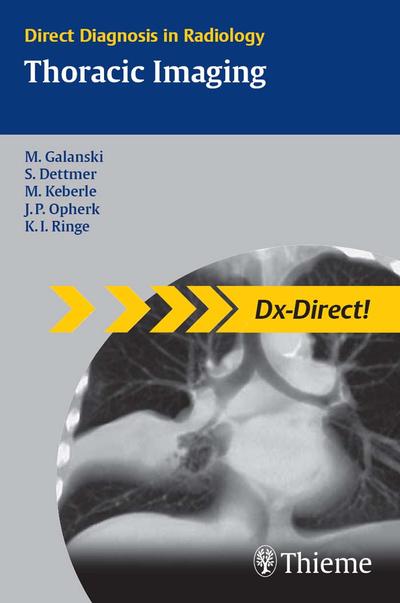Thoracic Imaging, Thieme, eBook, PDF - BUKU